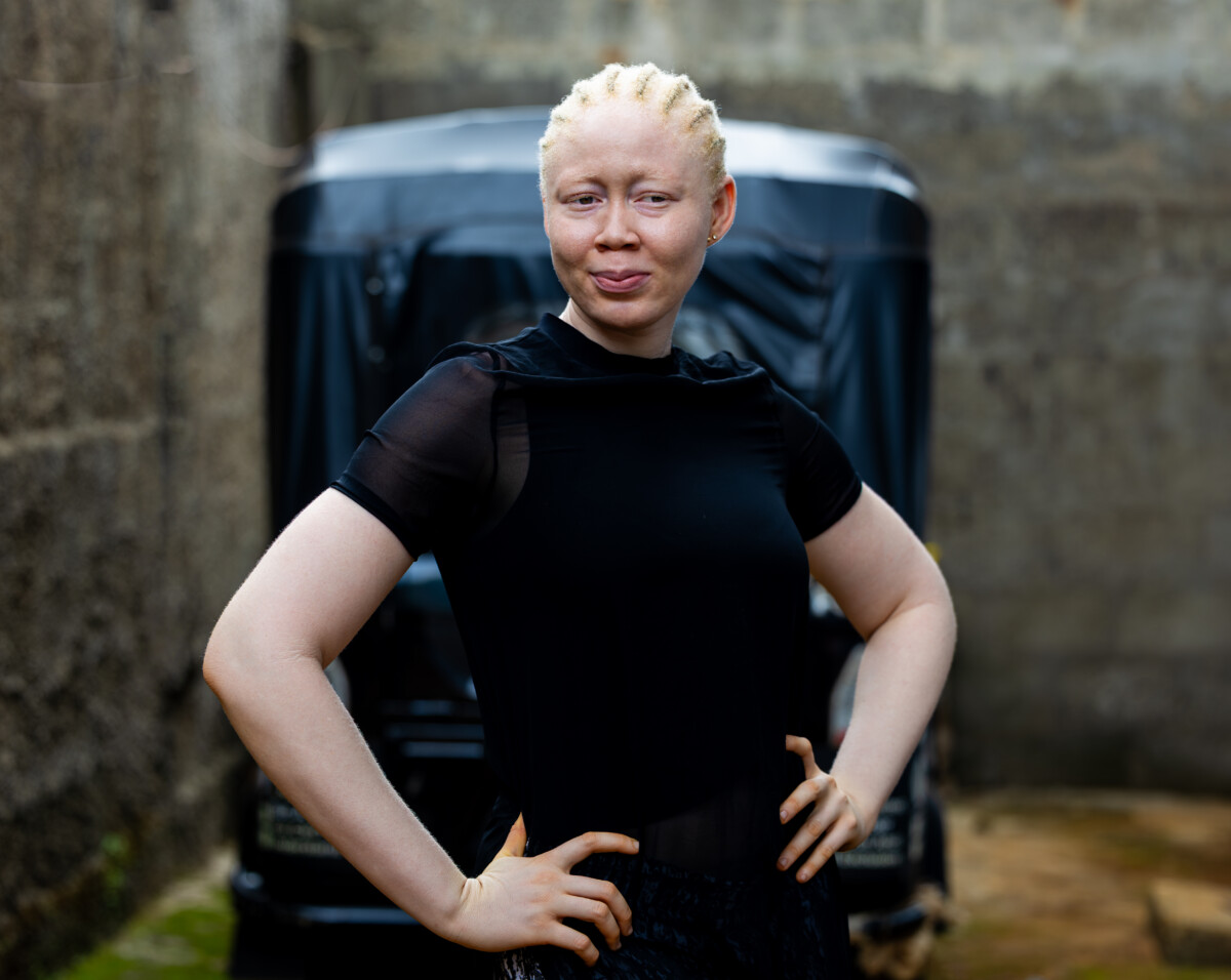 Daniella Garrick Set to Represent Sierra Leone at Mr. & Miss Albinism ...